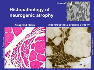 04.08.1b_Diseases_of_Skeletal_Muscle_final.pdf