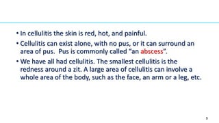 04. cellulitis.ppt