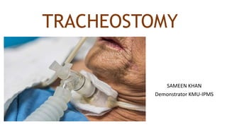 04. Tracheostomy.pptx