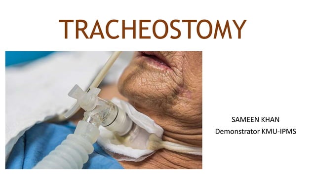 04. Tracheostomy.pptx