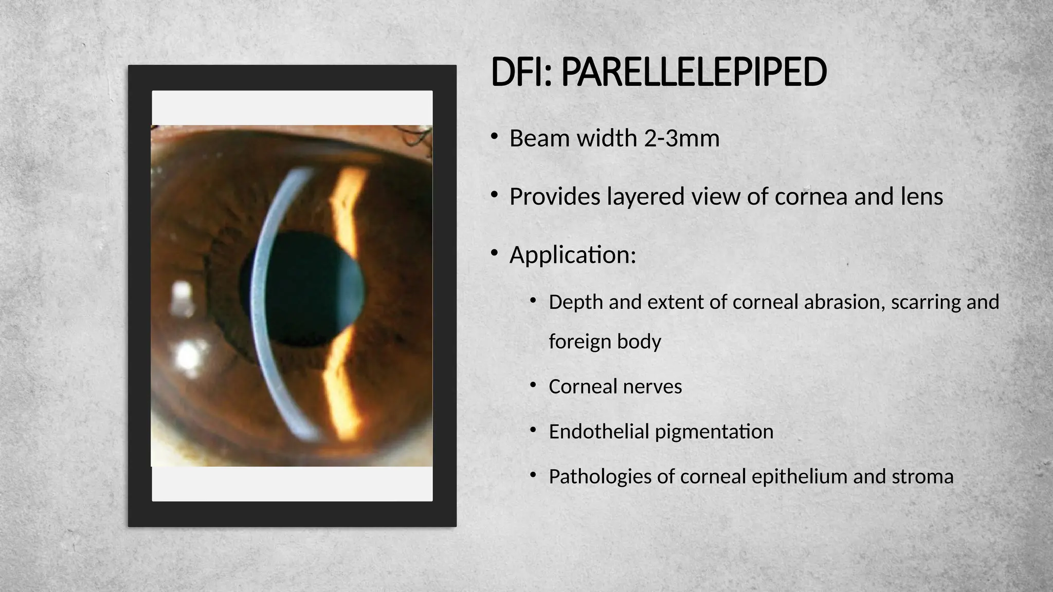 04. SLIT LAMP examination power point p | PPTX