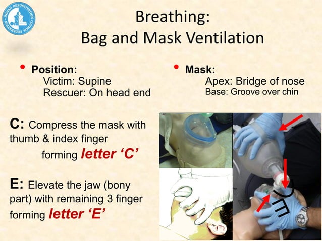 04 - Airway and Breathing.pdf anesthesia | PPT