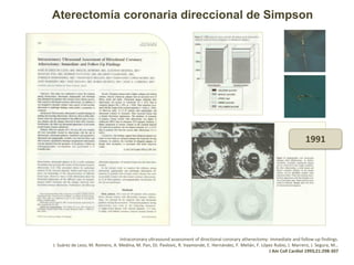 Aportaciones del grupo CORPAL en intervencionismo coronario | PPT