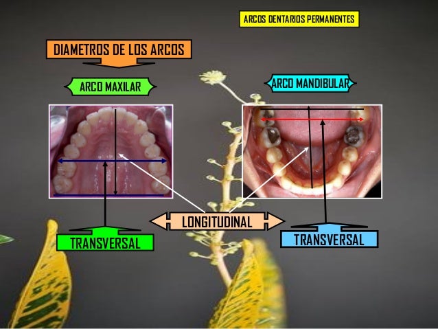 04 arcos dentarios-2014