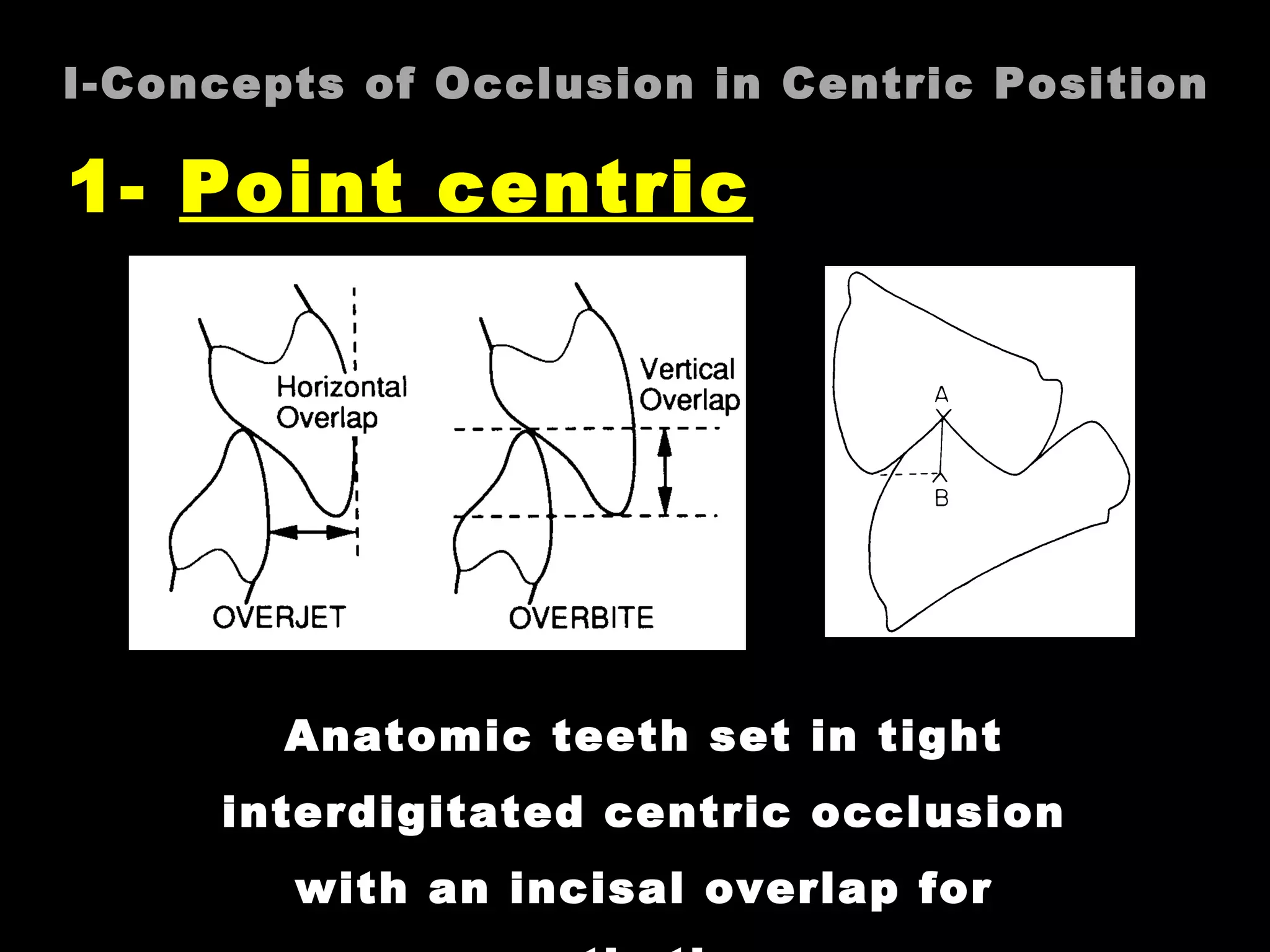 Concepts of Complete denture occlusion | PPT