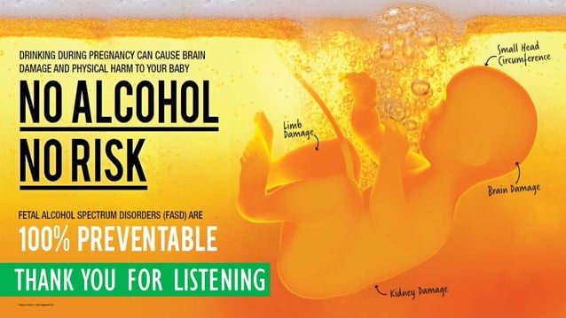 Fetal Alcohol Syndrome | PPT