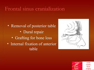 04 frontal sinus FRACTURE | PPT