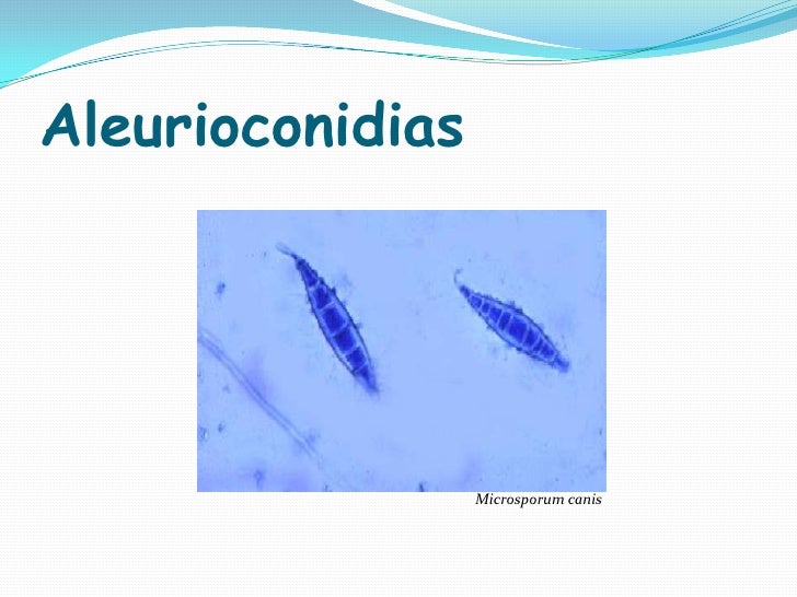 04 generalidades-de-hongos