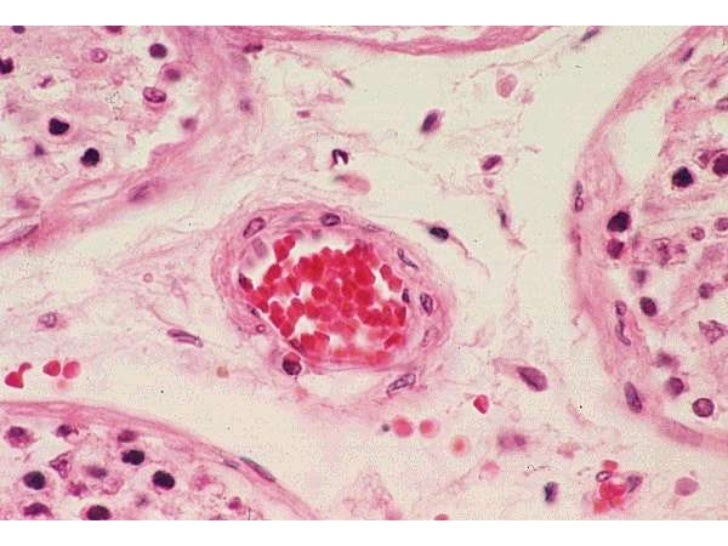 Histologia Dos Vasos Retos