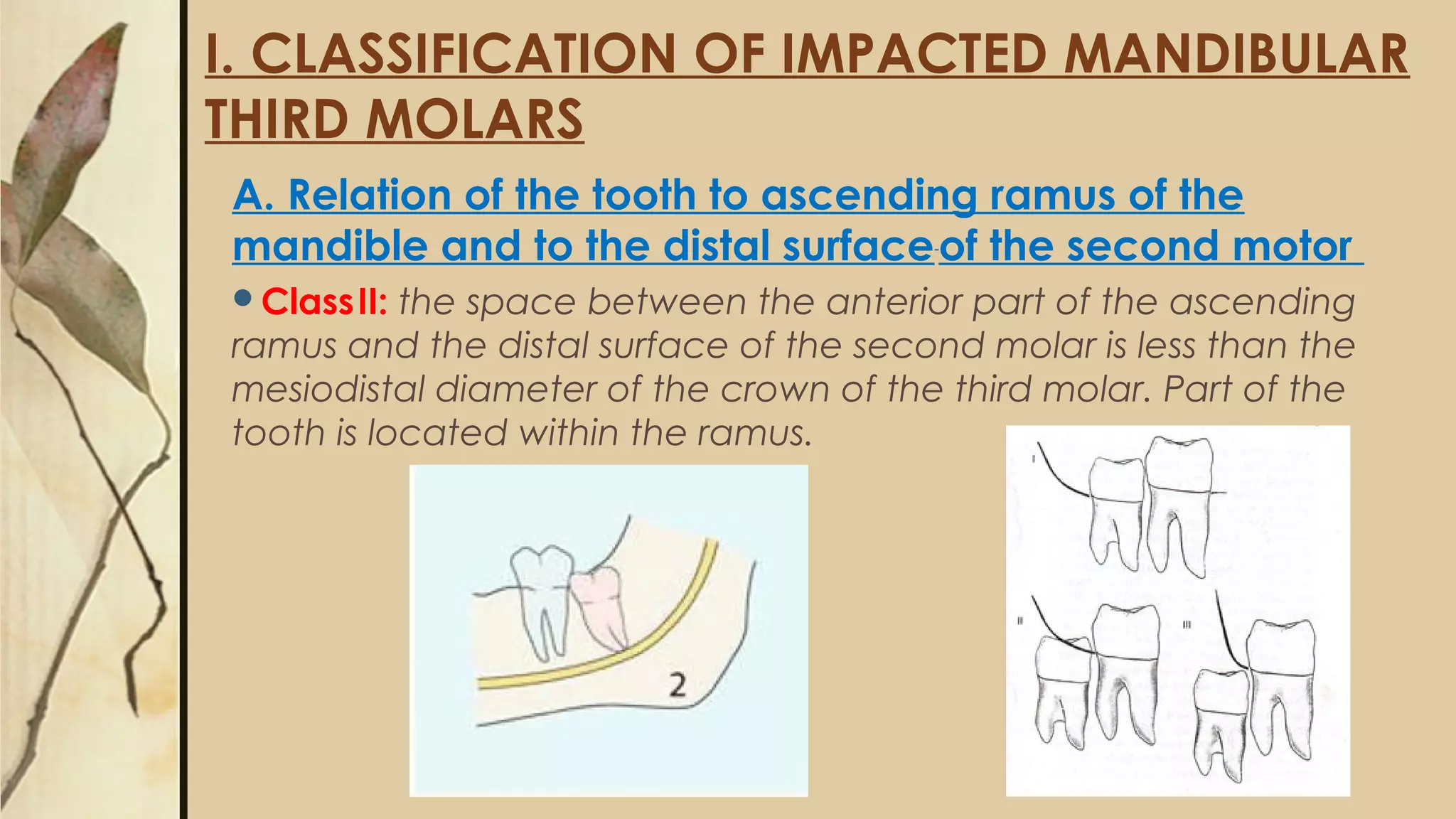 Surgical removal of Impacted teeth | PPT