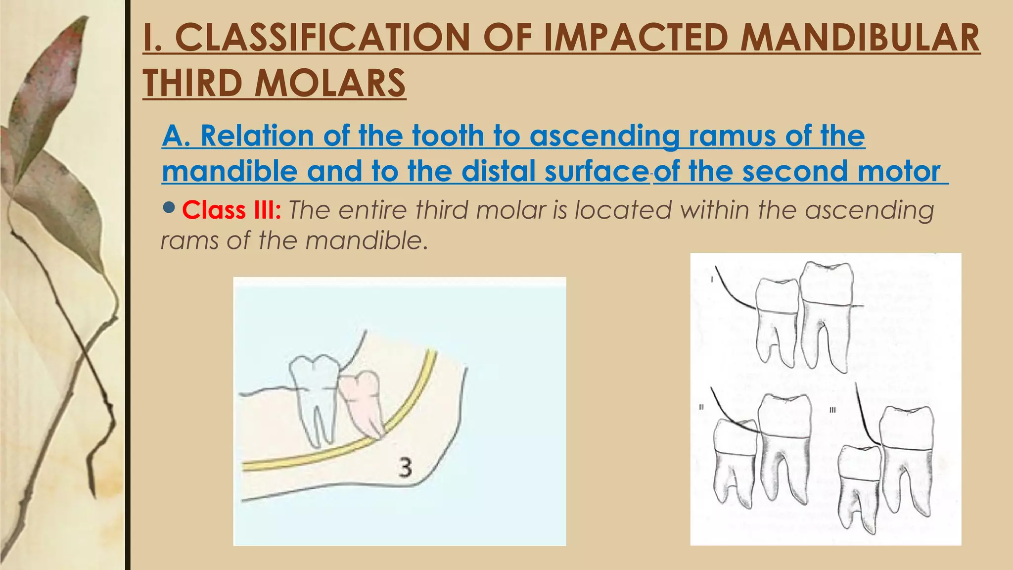 Surgical removal of Impacted teeth | PPT