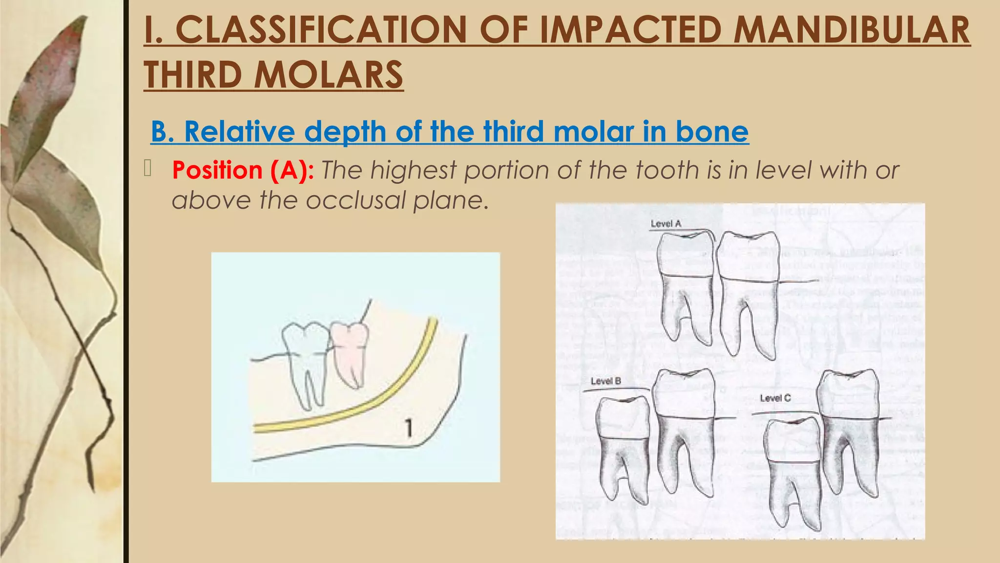 Surgical removal of Impacted teeth | PPT