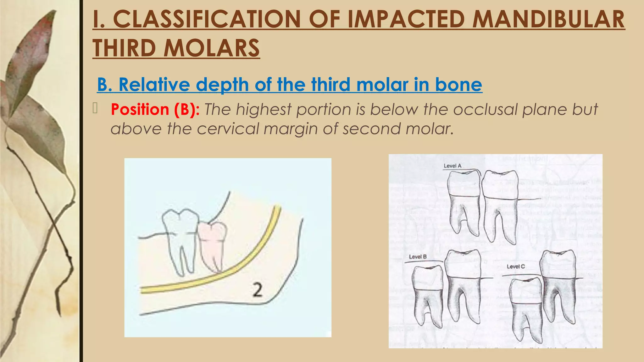 Surgical removal of Impacted teeth | PPT