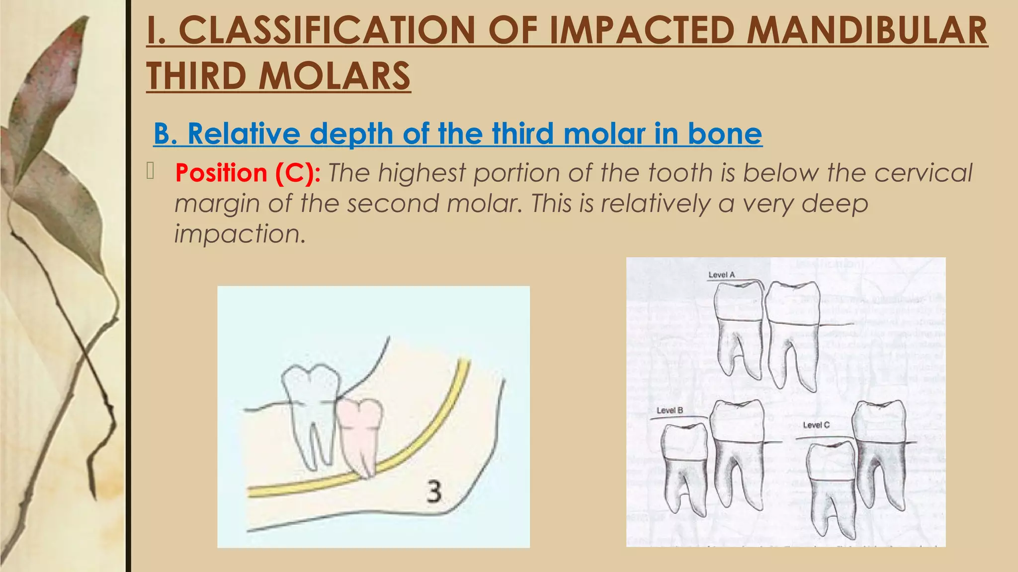 Surgical removal of Impacted teeth | PPT