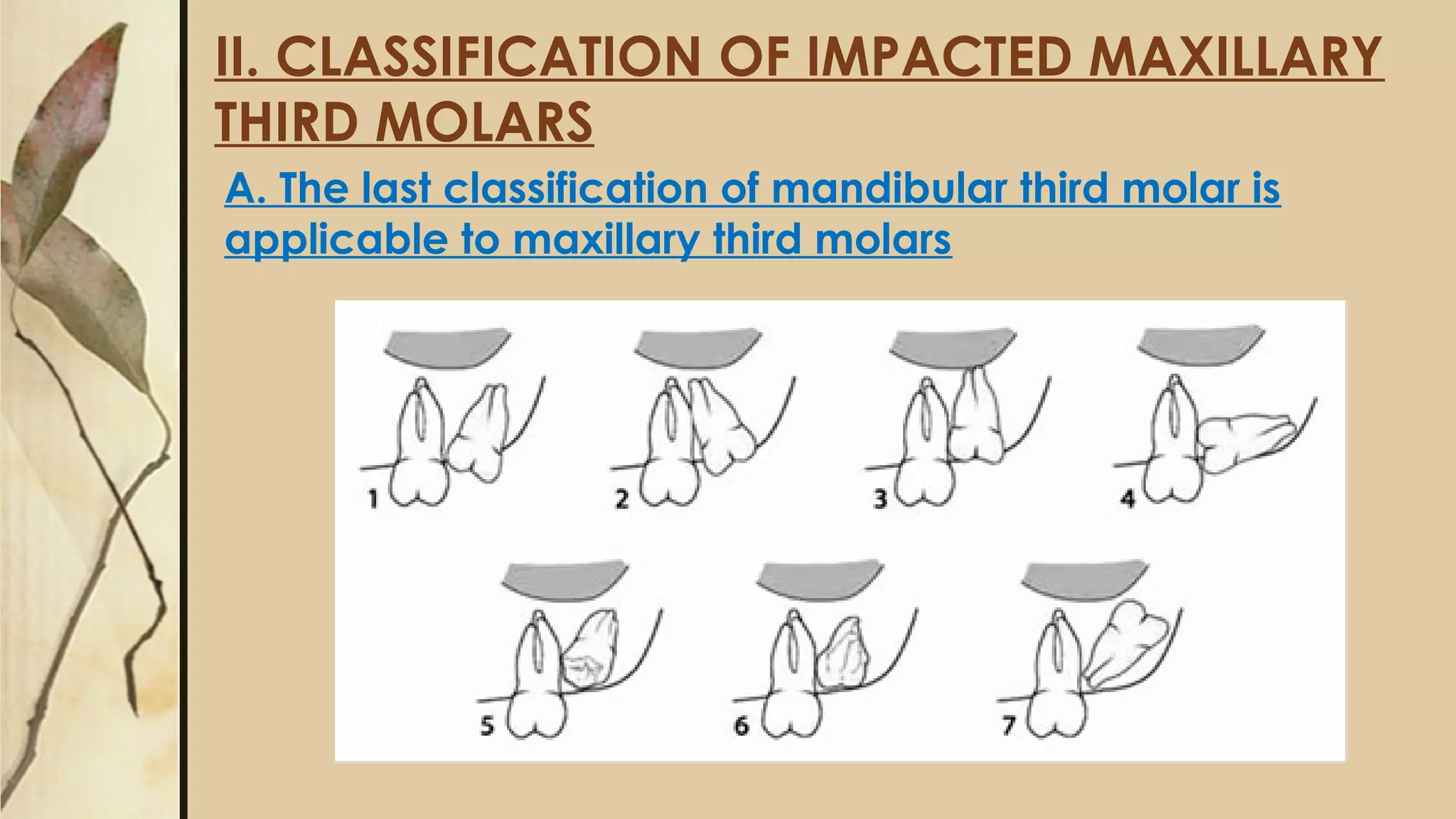 Surgical removal of Impacted teeth | PPT