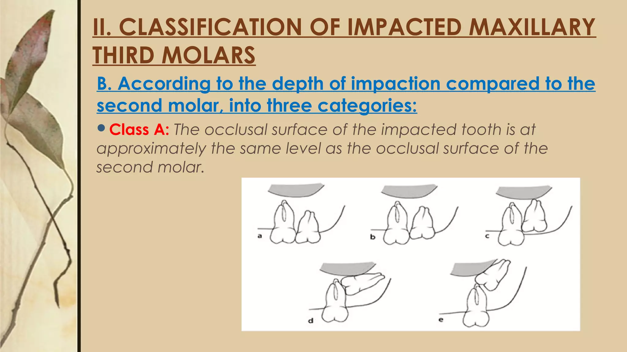 Surgical removal of Impacted teeth | PPT