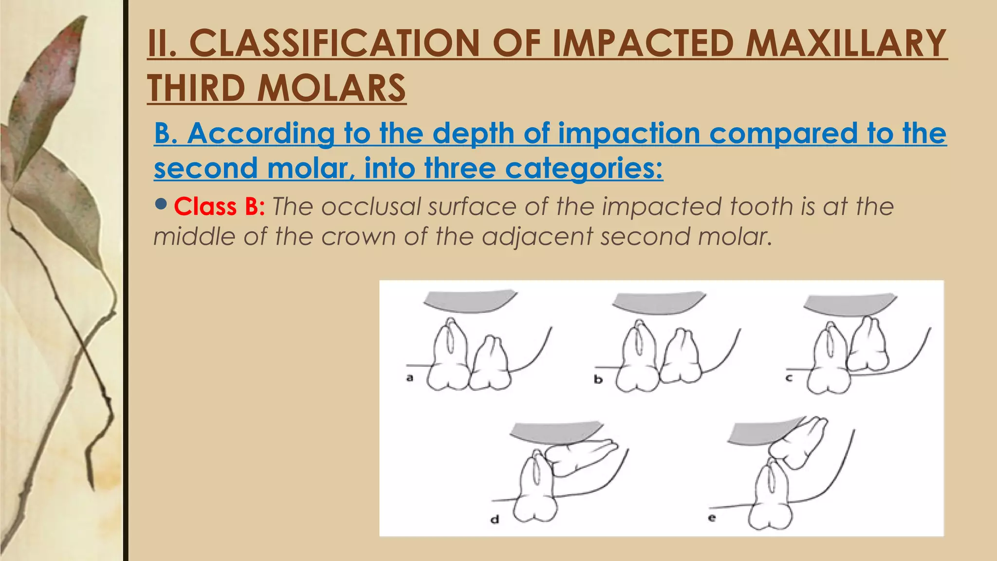 Surgical removal of Impacted teeth | PPT