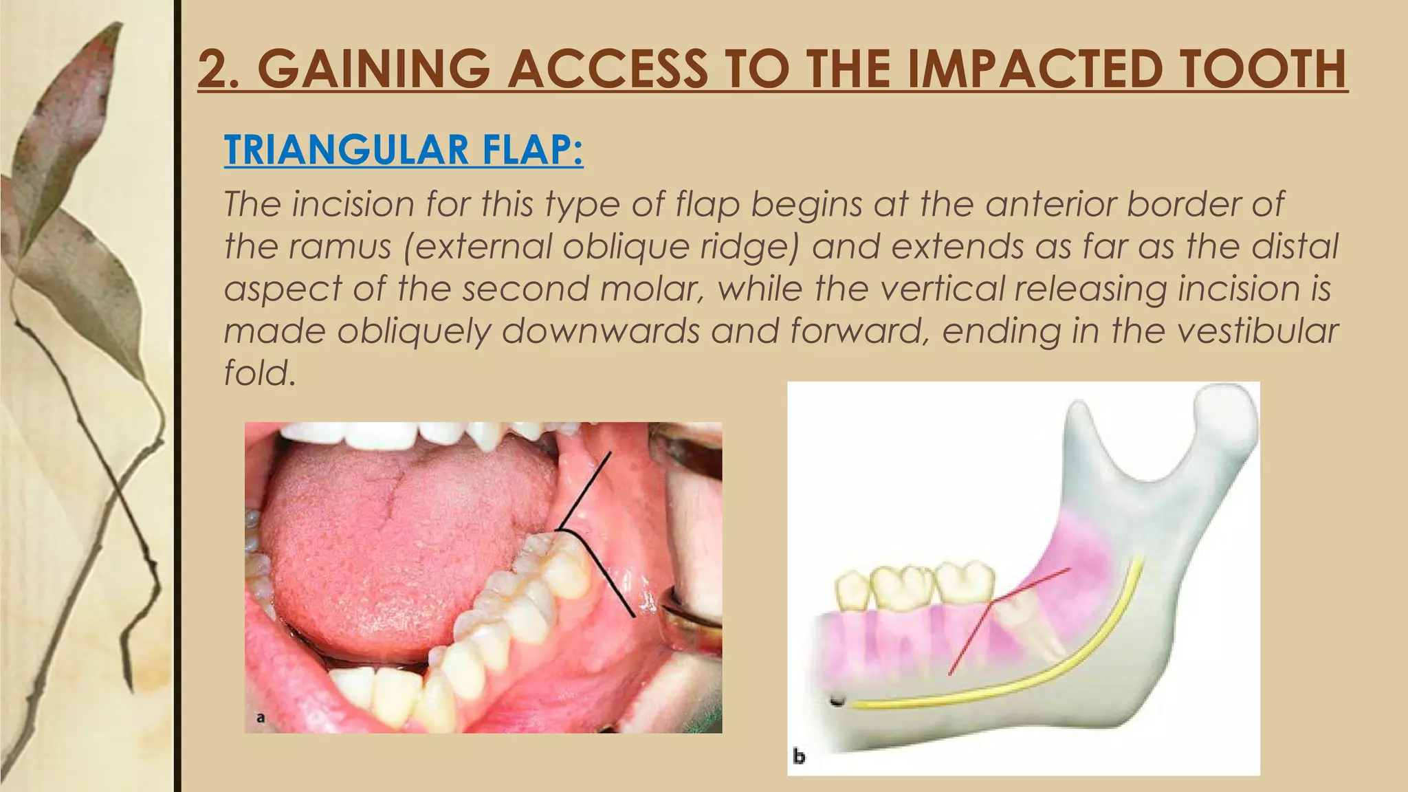 Surgical removal of Impacted teeth | PPT
