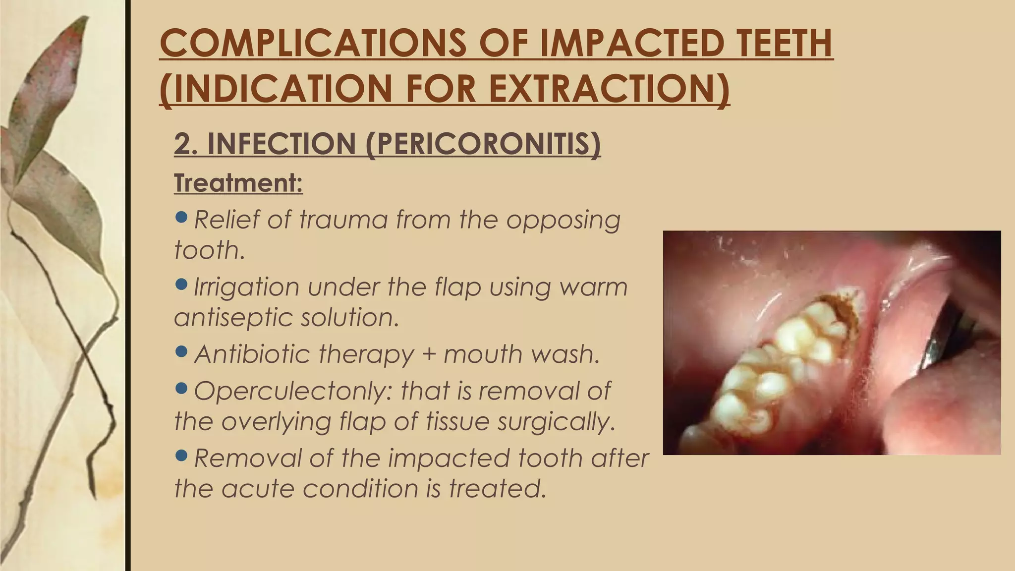 Surgical removal of Impacted teeth | PPT