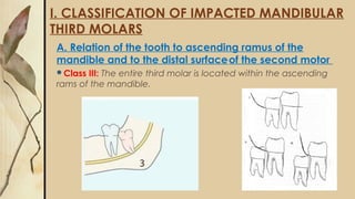 Surgical removal of Impacted teeth | PPT