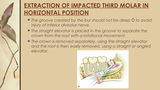 Surgical removal of Impacted teeth | PPT