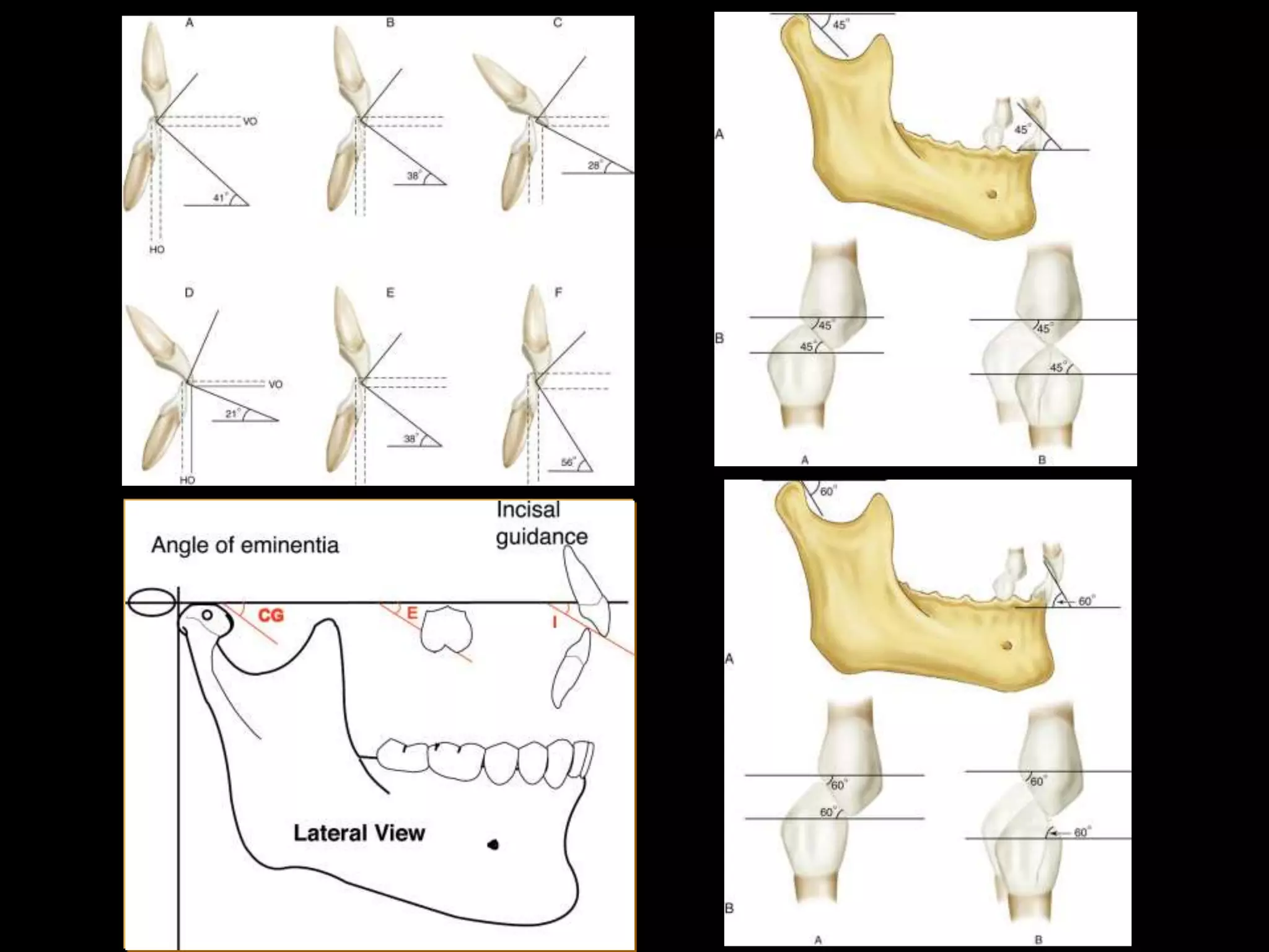 04- Occlusion in prosthodontics- Concepts of occlusion.ppt