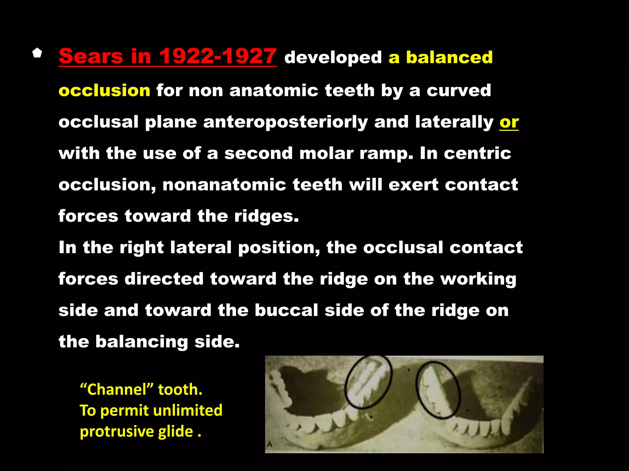 04- Occlusion in prosthodontics- Concepts of occlusion.ppt