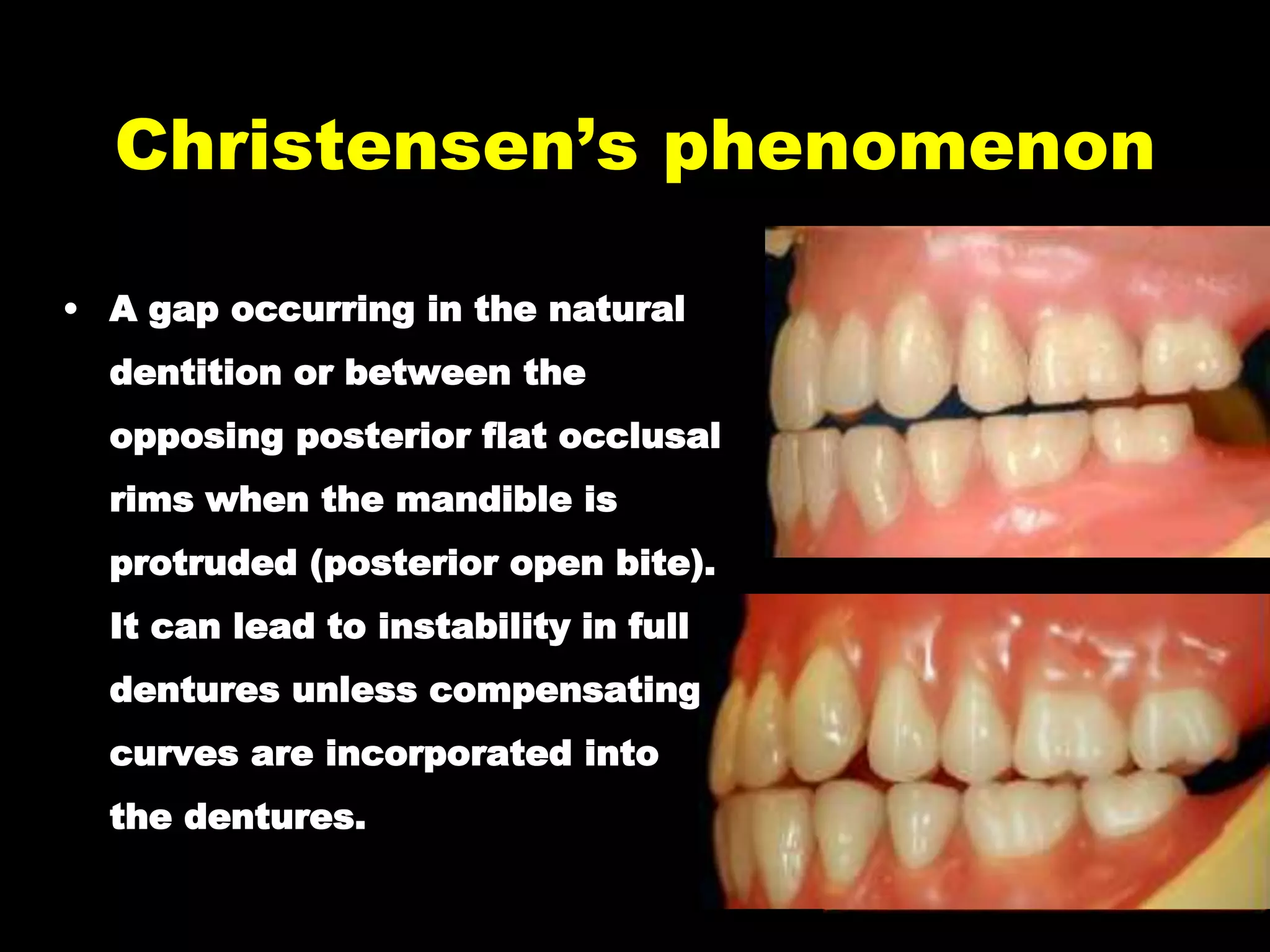 04- Occlusion in prosthodontics- Concepts of occlusion.ppt