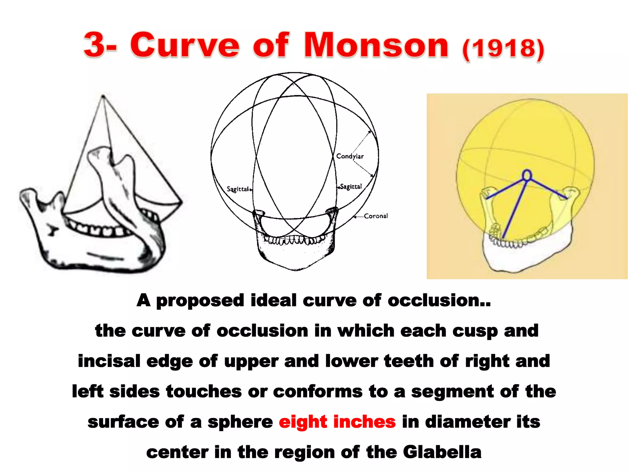 04- Occlusion in prosthodontics- Concepts of occlusion.ppt