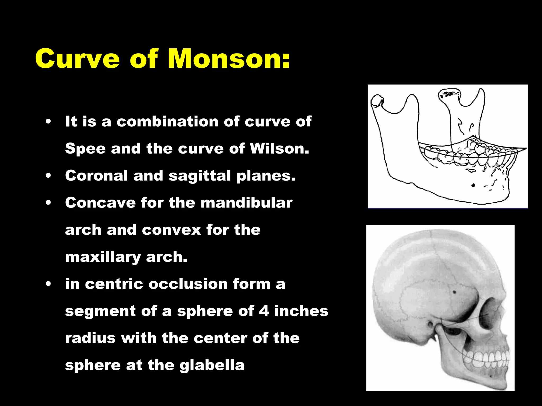 04- Occlusion in prosthodontics- Concepts of occlusion.ppt