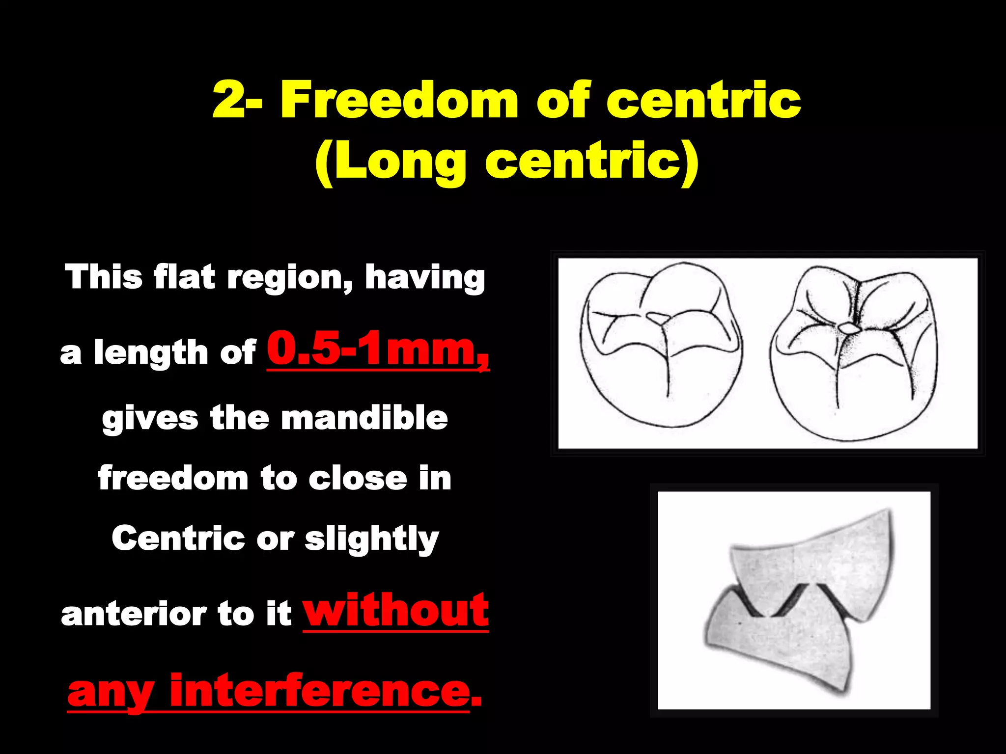04- Occlusion in prosthodontics- Concepts of occlusion.ppt