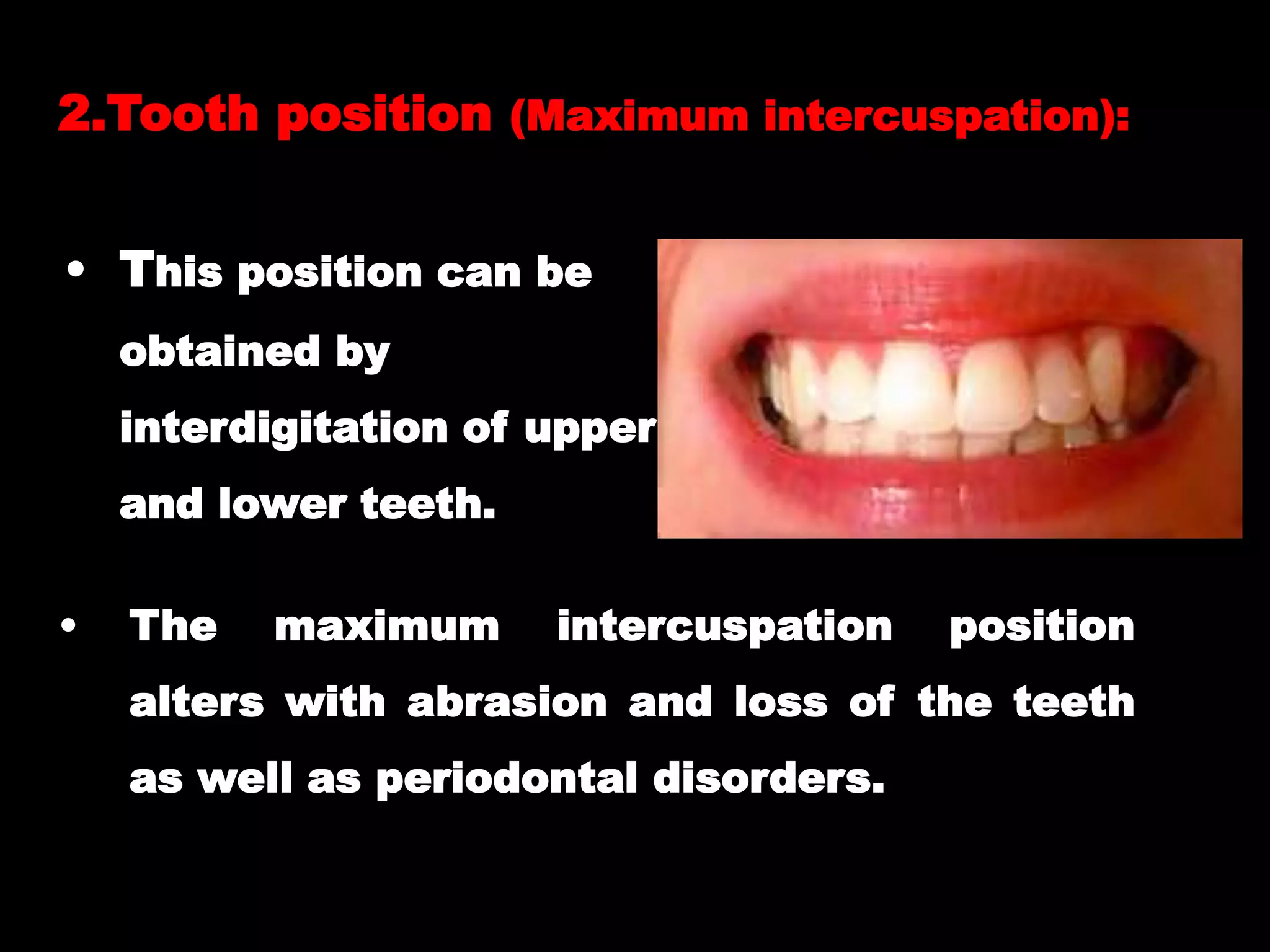 04- Occlusion in prosthodontics- Concepts of occlusion.ppt
