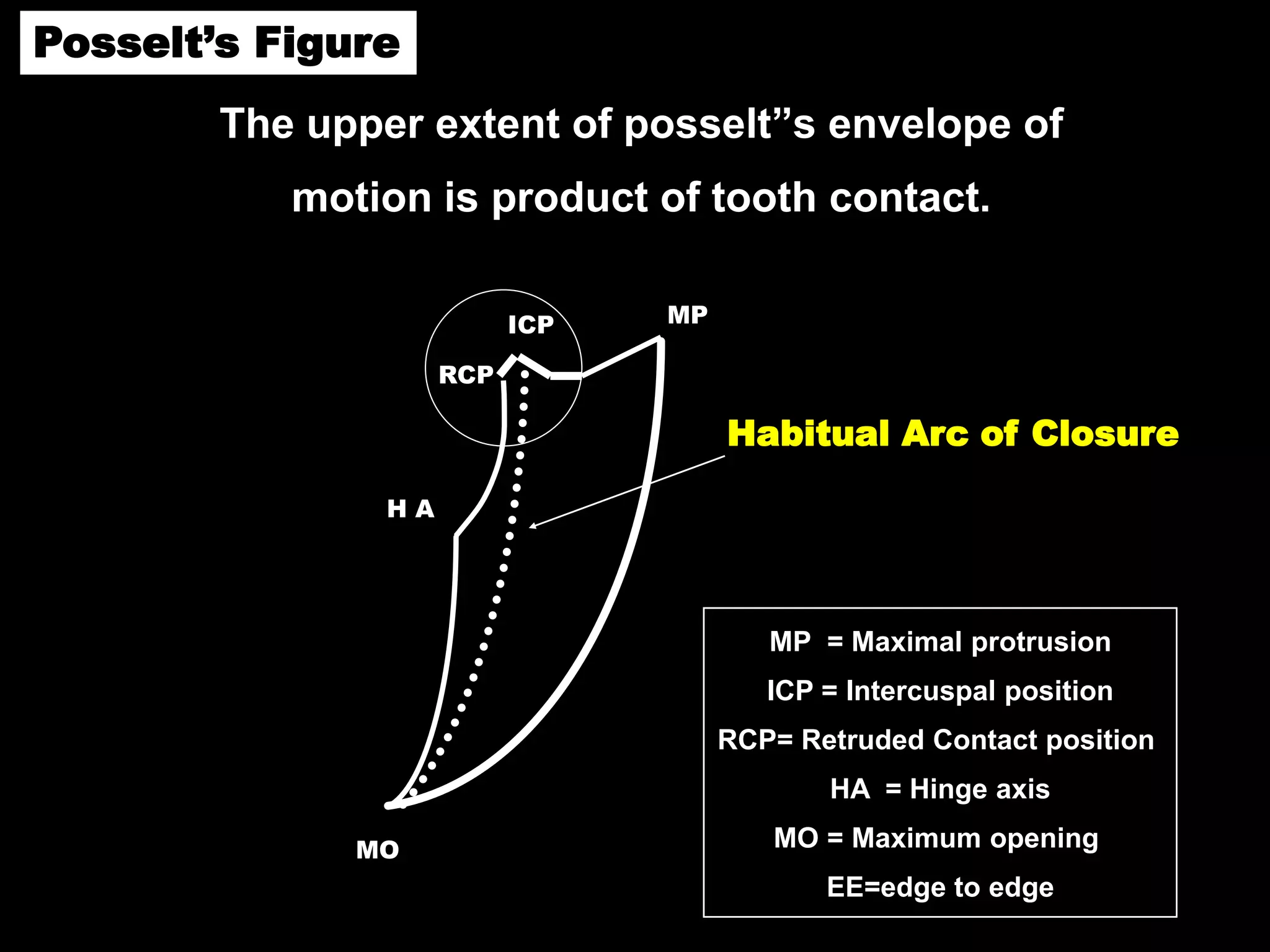 04- Occlusion in prosthodontics- Concepts of occlusion.ppt