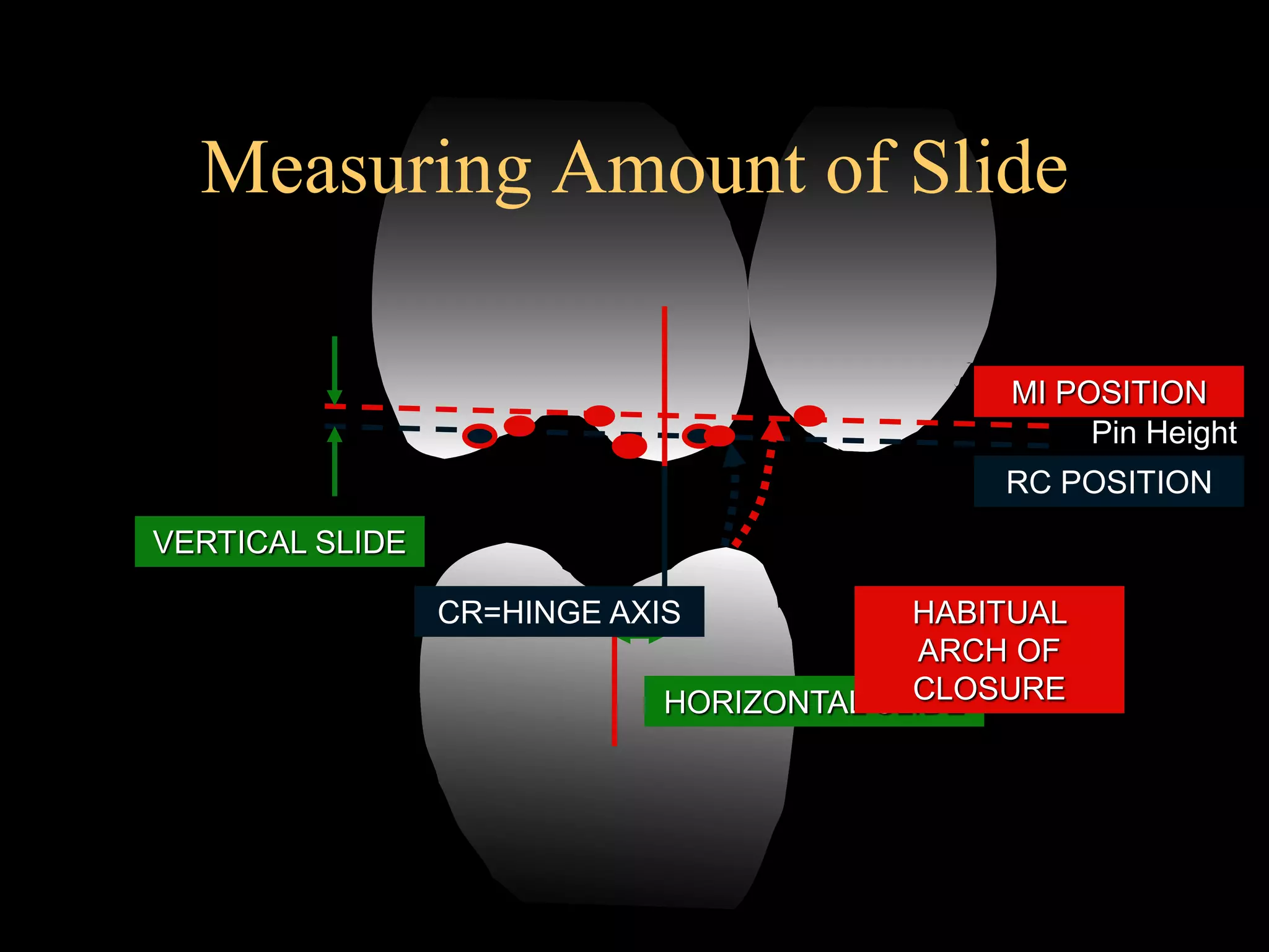 04- Occlusion in prosthodontics- Concepts of occlusion.ppt