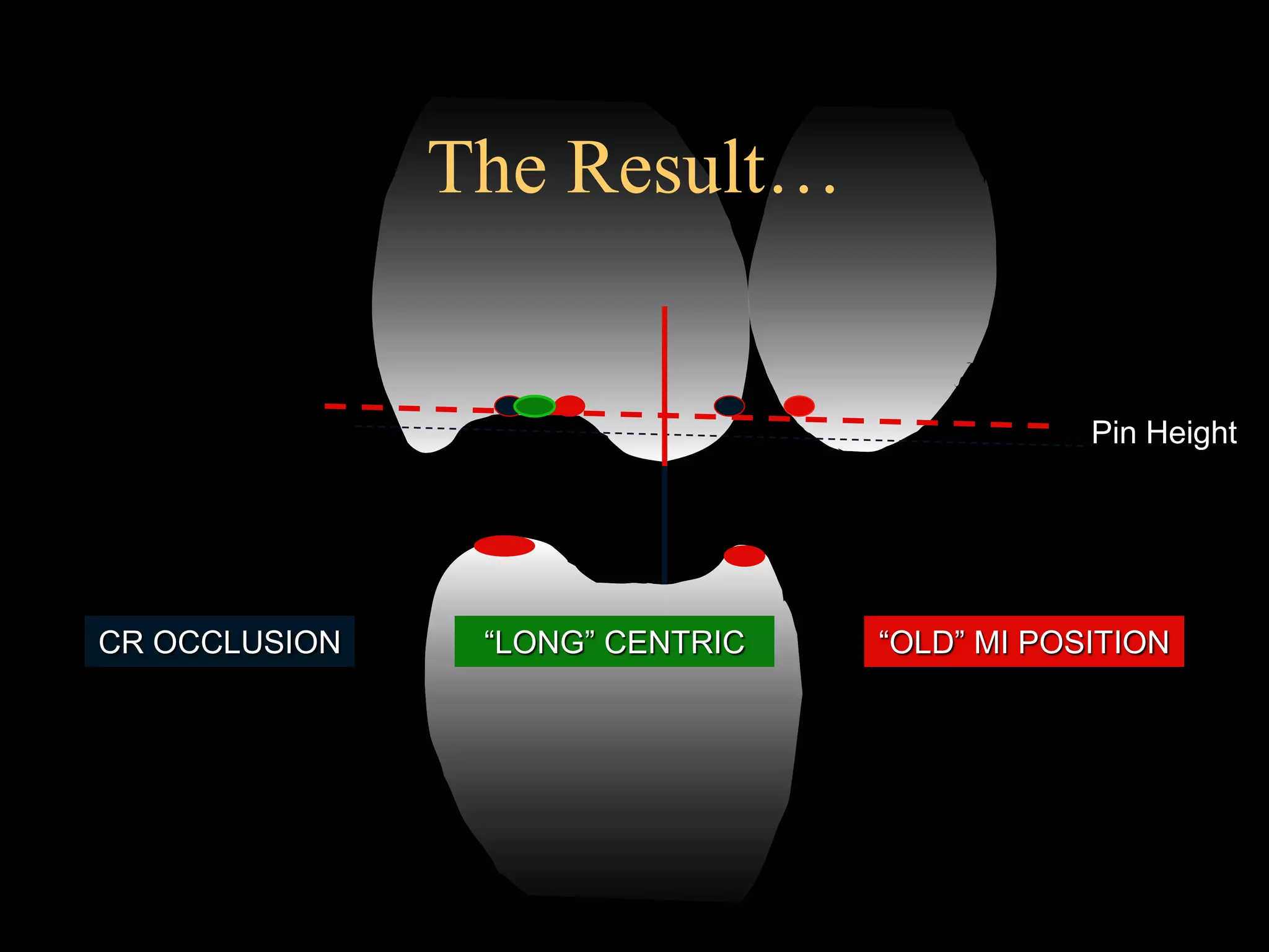 04- Occlusion in prosthodontics- Concepts of occlusion.ppt