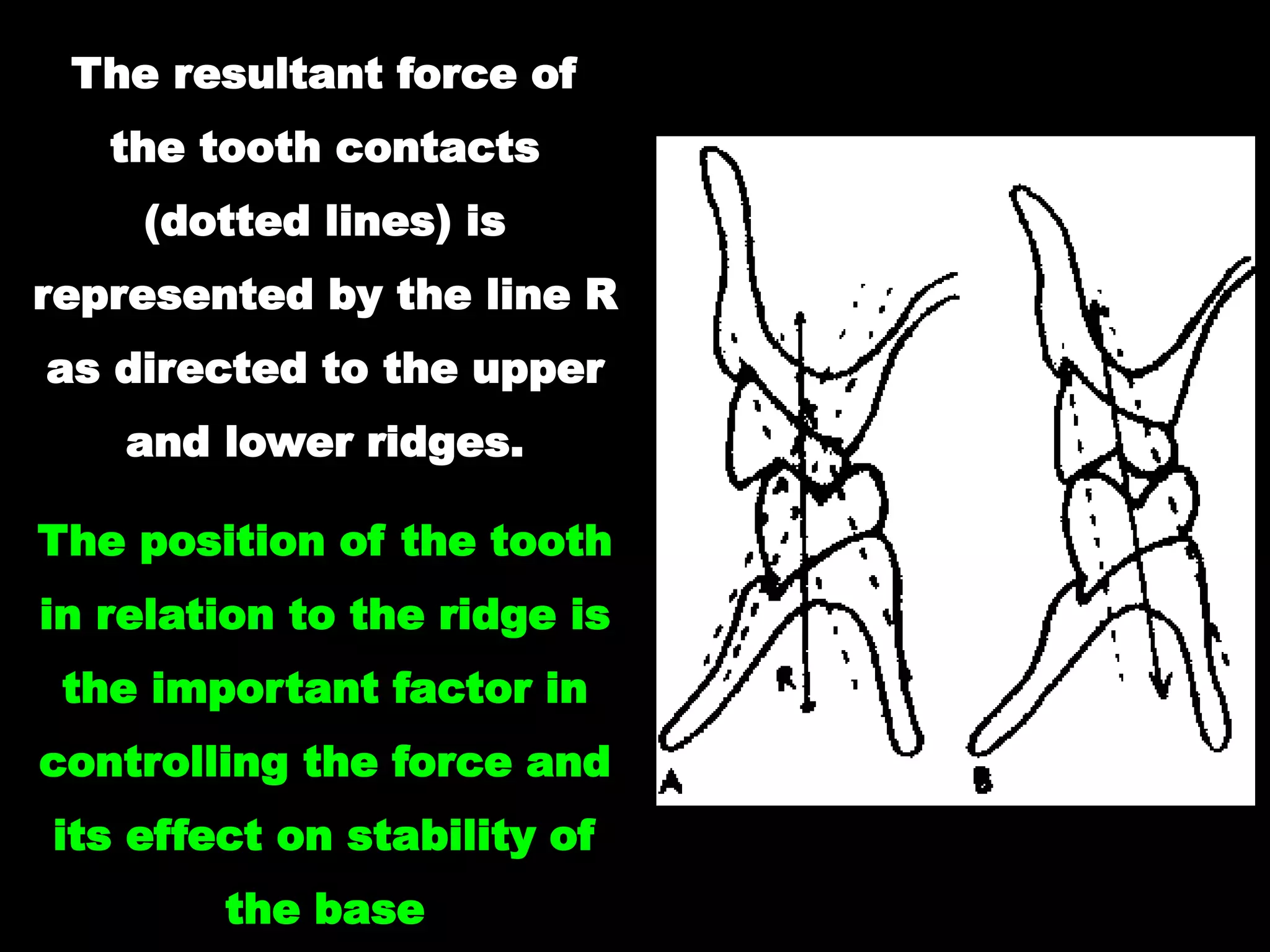 04- Occlusion in prosthodontics- Concepts of occlusion.ppt