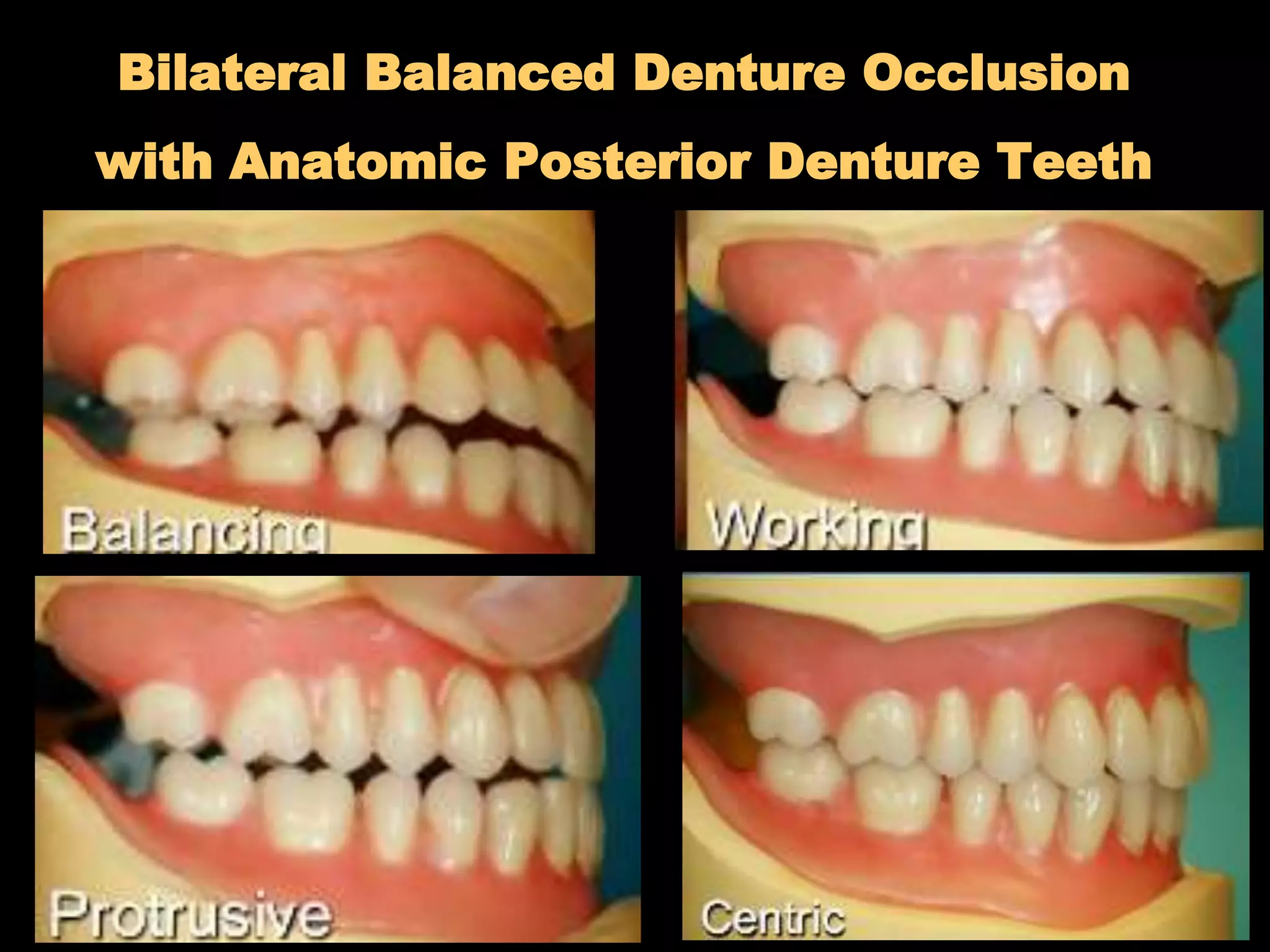 04- Occlusion in prosthodontics- Concepts of occlusion.ppt