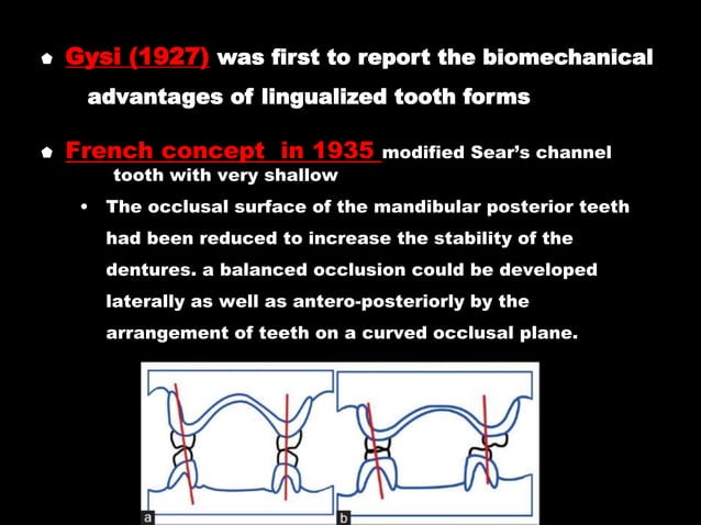 04- Occlusion in prosthodontics- Concepts of occlusion.ppt | Dental ...