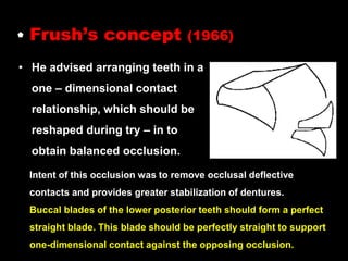 04- Occlusion in prosthodontics- Concepts of occlusion.ppt