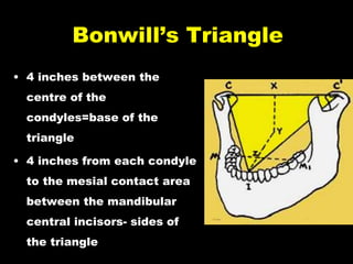 04- Occlusion in prosthodontics- Concepts of occlusion.ppt