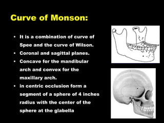 04- Occlusion in prosthodontics- Concepts of occlusion.ppt