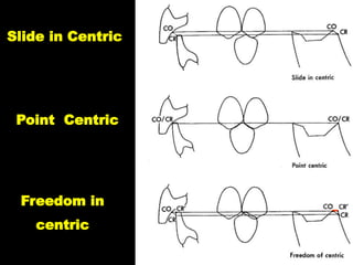 04- Occlusion in prosthodontics- Concepts of occlusion.ppt