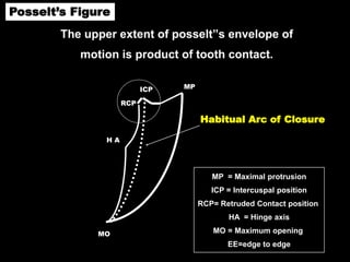04- Occlusion in prosthodontics- Concepts of occlusion.ppt