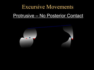 04- Occlusion in prosthodontics- Concepts of occlusion.ppt