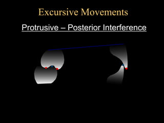 04- Occlusion in prosthodontics- Concepts of occlusion.ppt