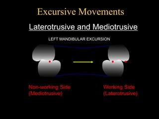 04- Occlusion in prosthodontics- Concepts of occlusion.ppt