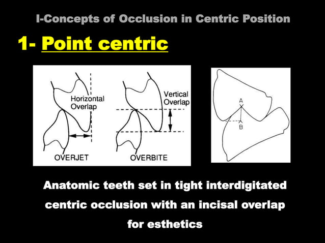 04- Occlusion in prosthodontics- Concepts of occlusion.ppt