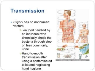 Typhoid_Fever.ppt