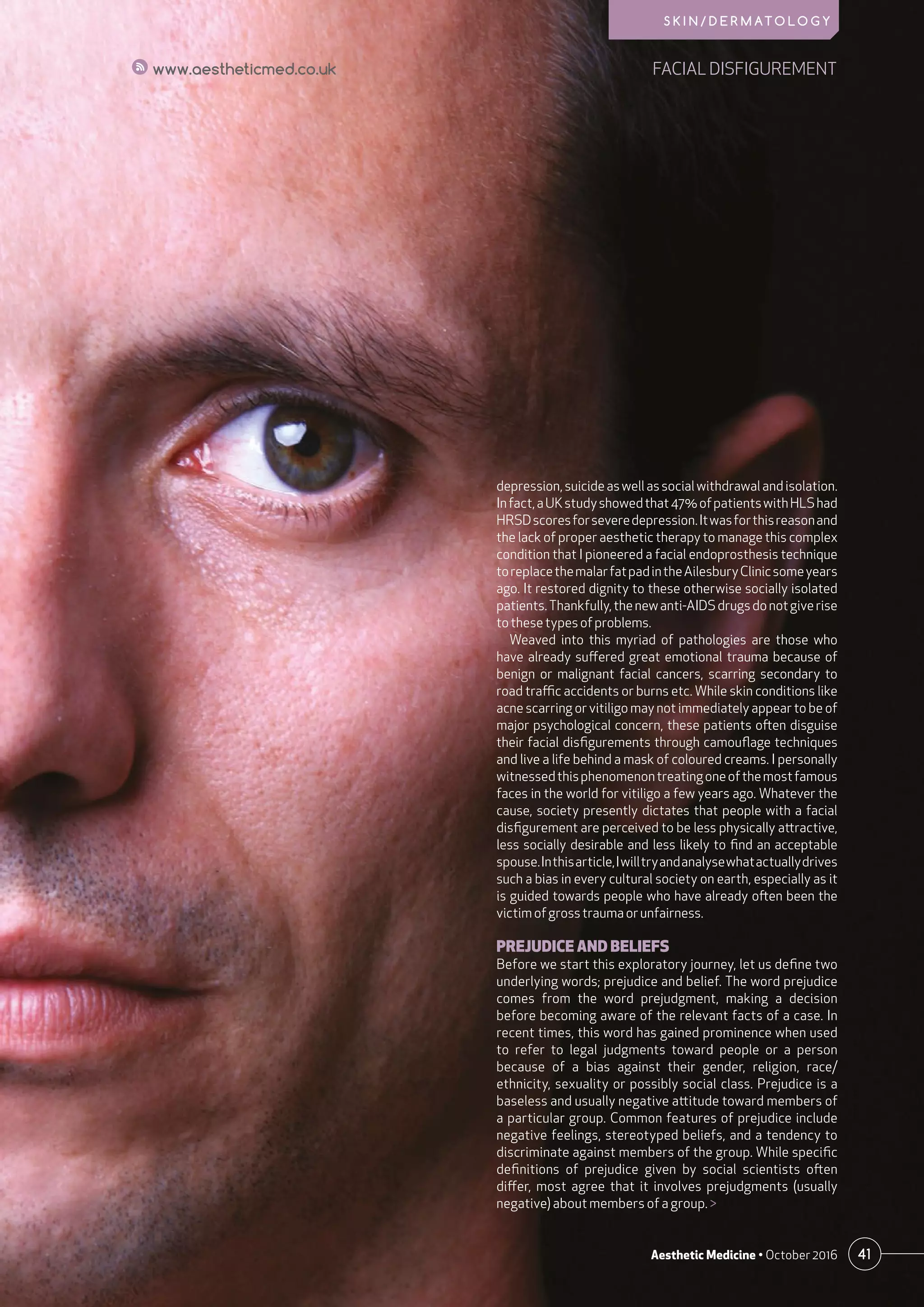 'Facial Disfigurement' by Dr. Patrick Treacy | PDF