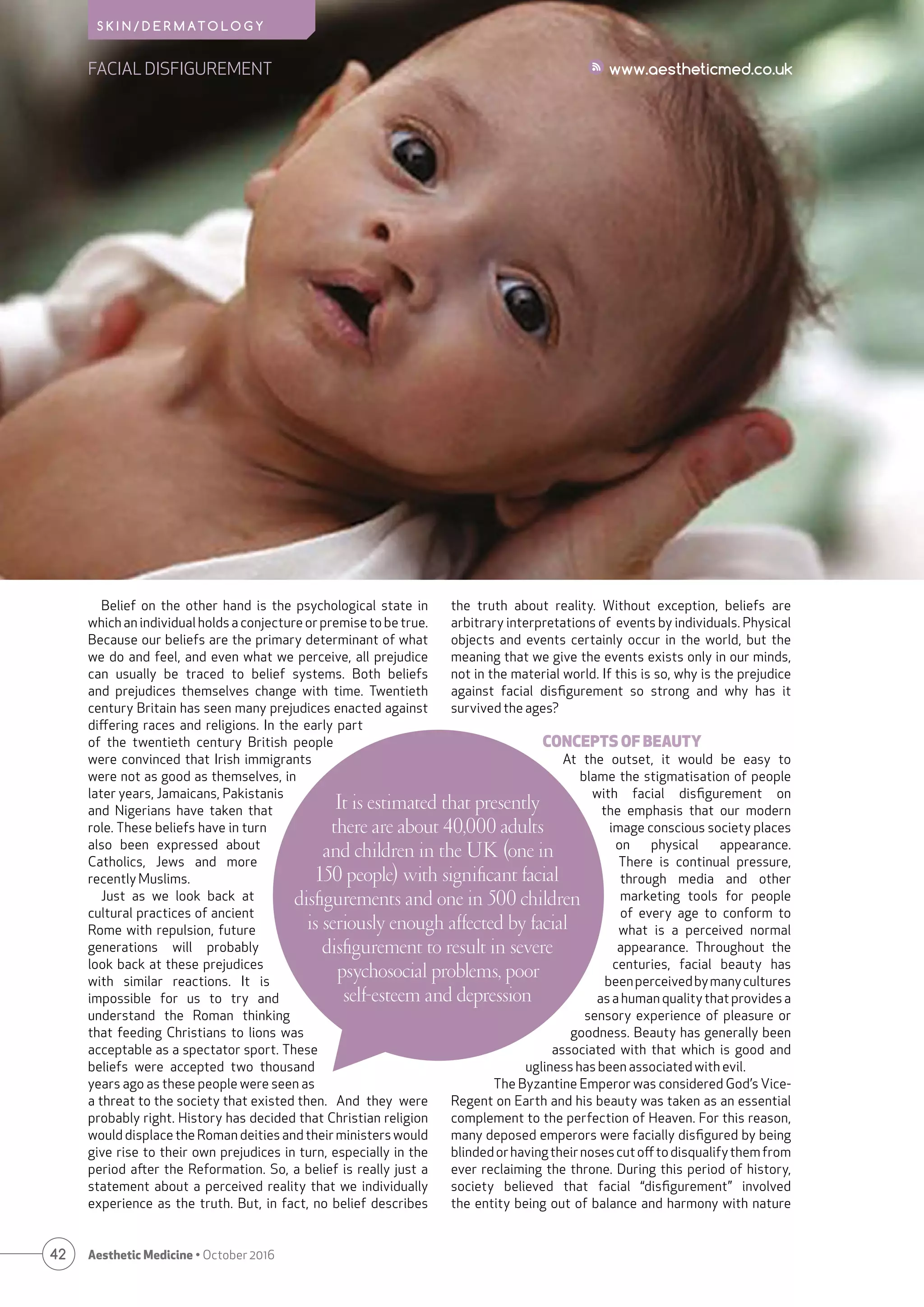 'Facial Disfigurement' by Dr. Patrick Treacy | PDF